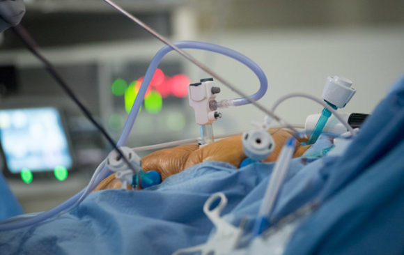 Hipek Tedavisi - Prof. Dr. Hasan TAŞÇI